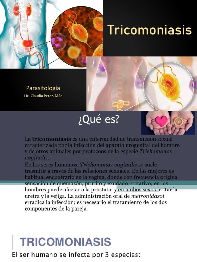 Tricomoniasis | PDF