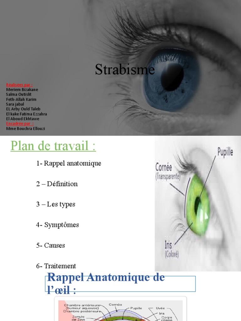 Strabisme | PDF | Cerveau | Œil