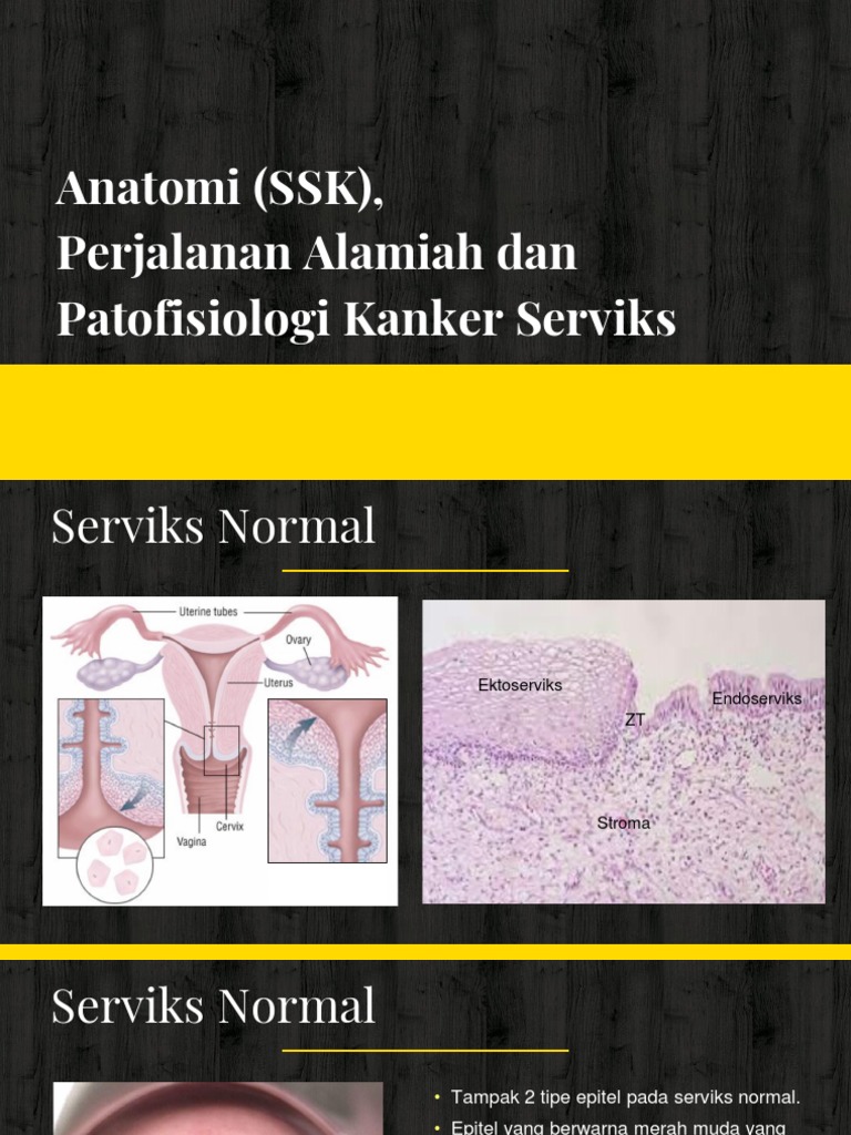 Deteksi Dini Kanker Leher Rahim Dengan Tes IVA - Anatomi (SSK ...