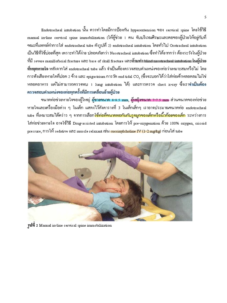 รูปที่ Manual in-line cervical spine immobilization | PDF