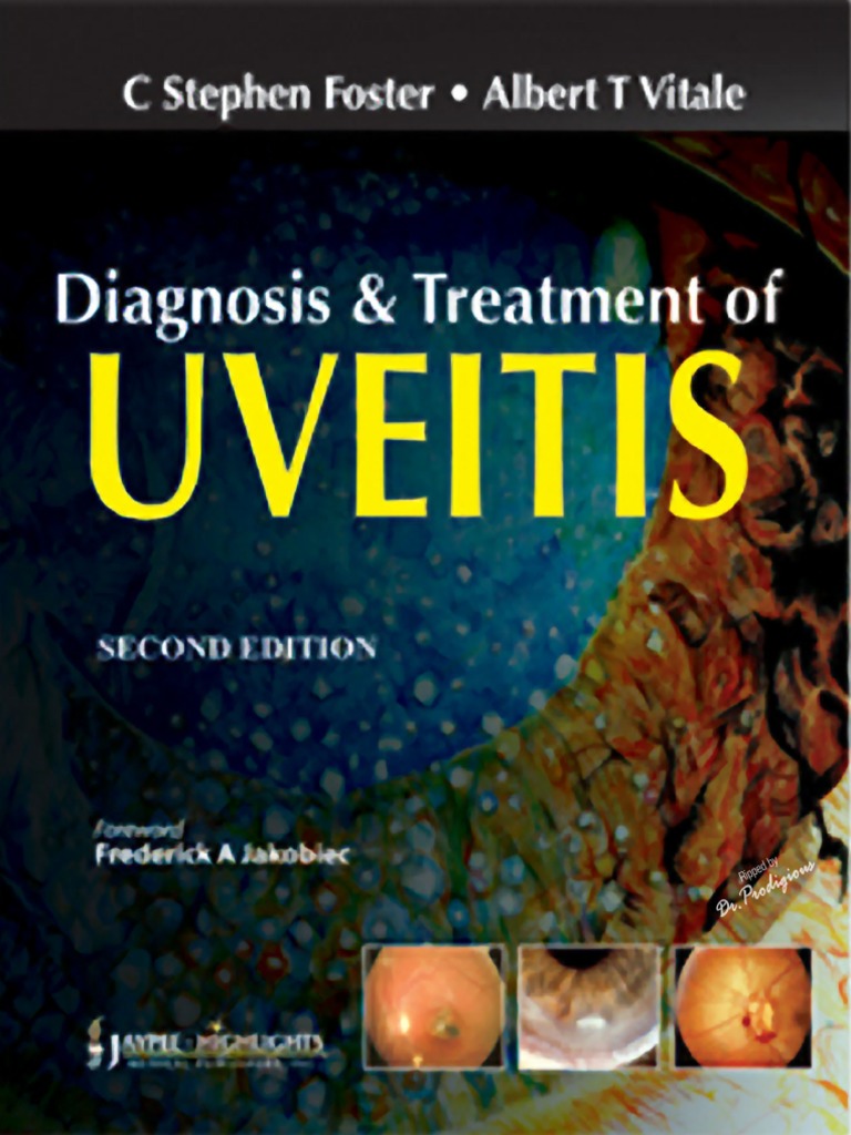 Diagnosis and Treatment of Uveitis - 2nd Edition - FOSTER | PDF | Ophthalmology | Medicine