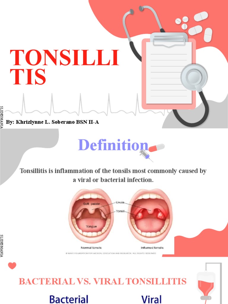 Tonsillitis | PDF | Epidemiology | Public Health
