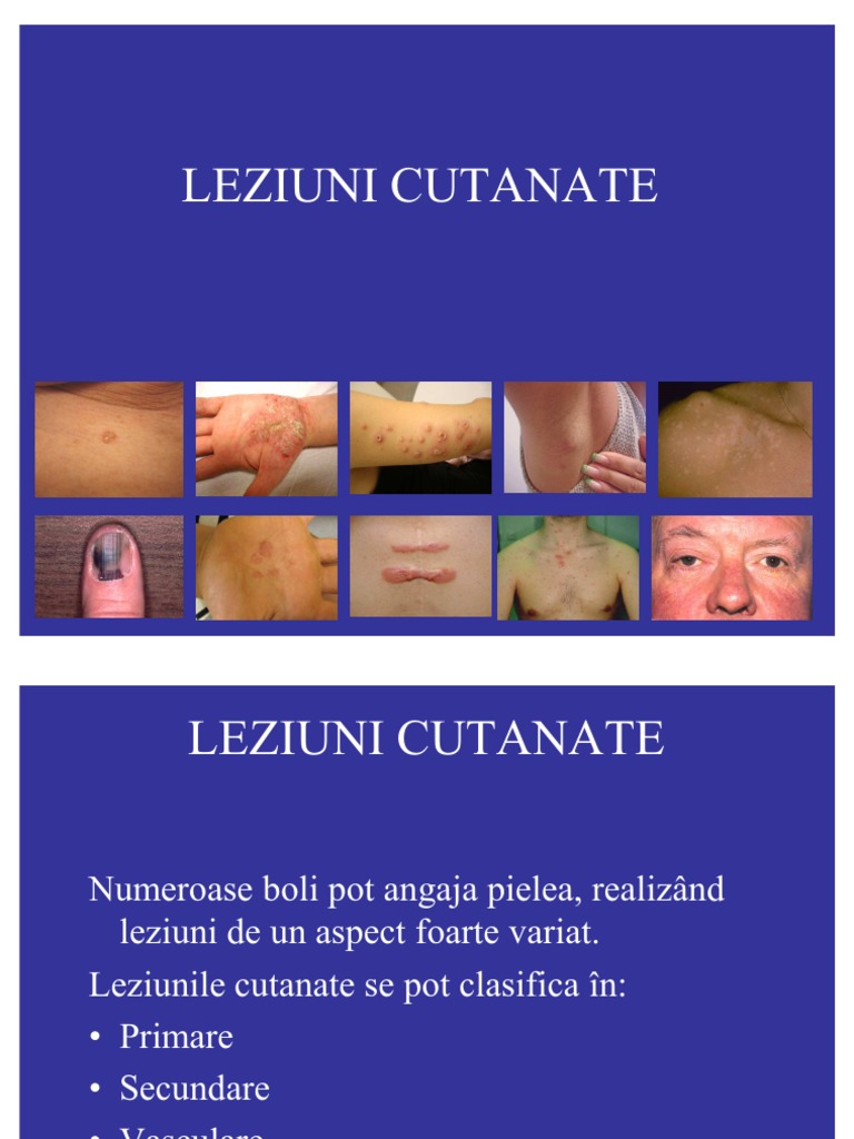 leziuni cutanate