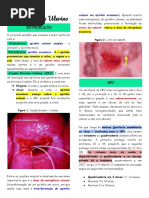 Ectopia Cervical: Definição e Tratamento | PDF | Câncer cervical ...