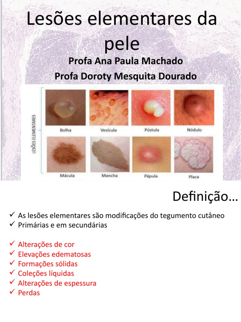 Classificação e descrição das lesões elementares da pele | PDF