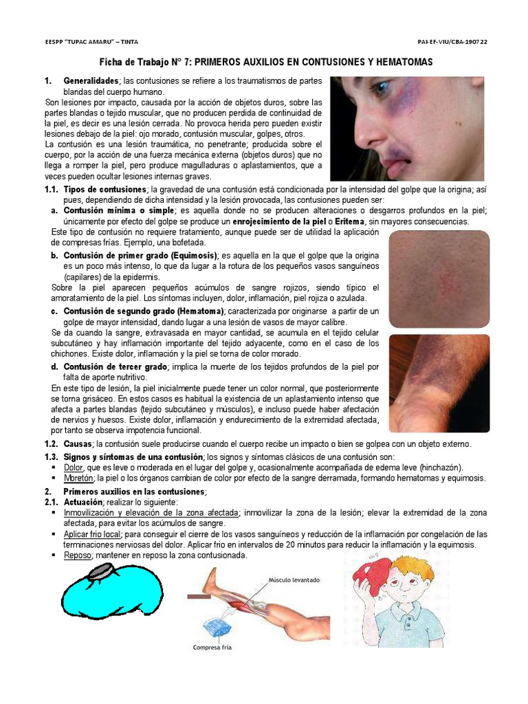Clase 7-Contusiones y Hematomas | PDF | Primeros auxilios | Piel