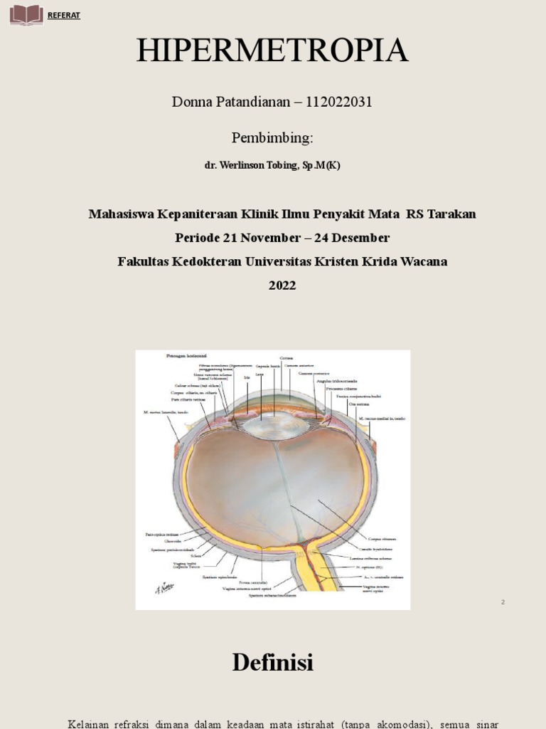 Refrat Donna Hipermetropia | PDF