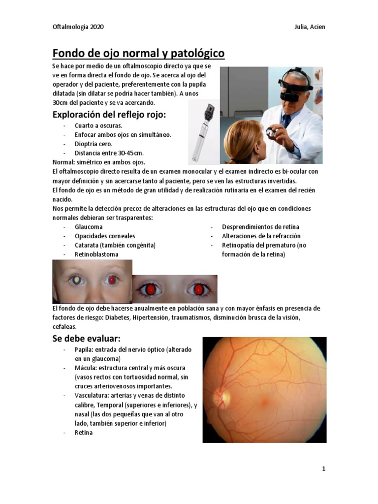 Oftalmología Fondo de Ojo Normal y Patológico 2020 | PDF | Ojo humano ...