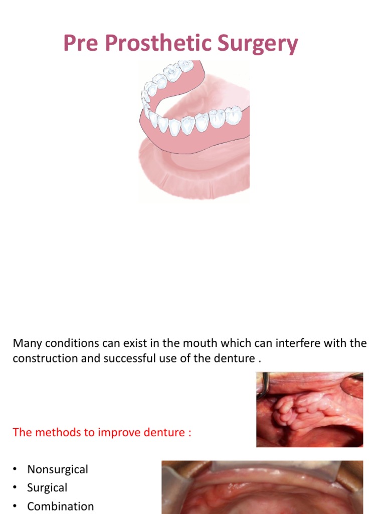 Pre Prosthetic Surgery | PDF | Dentures | Clinical Medicine