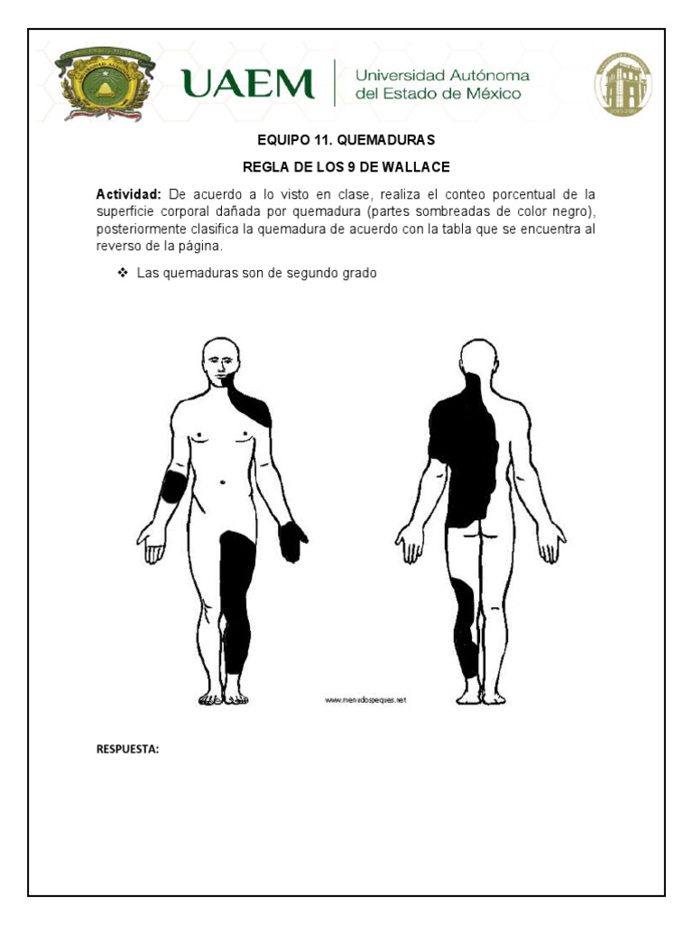 Clasificación de Quemaduras según SCQ | PDF