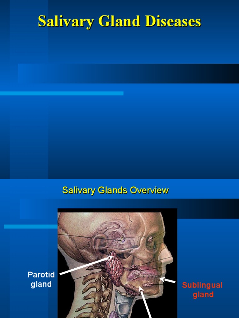 Salivary Gland Disease and Management | PDF