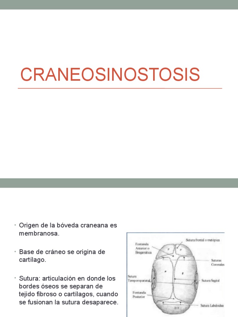 Craneosinostosis: Tipos y Genética | PDF | Enfermedades y trastornos ...