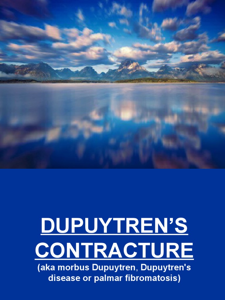 Dupuytren's Contracture | PDF | Causes Of Death | Medicine