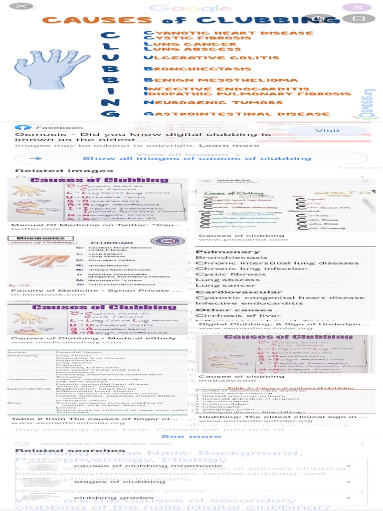 Causes of Clubbing - Google Search | PDF | Hypoxia (Medical) | Human ...