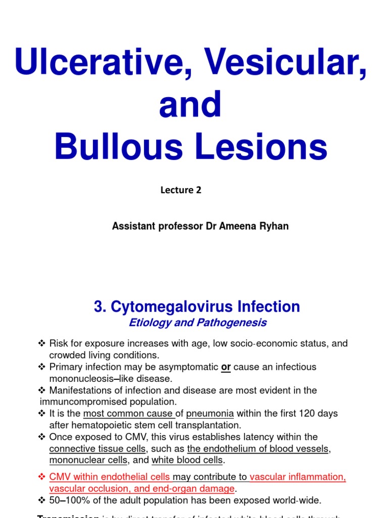 Ulcerative Vesicular Bullous Lesions 2 | PDF | Infection | Periodontology