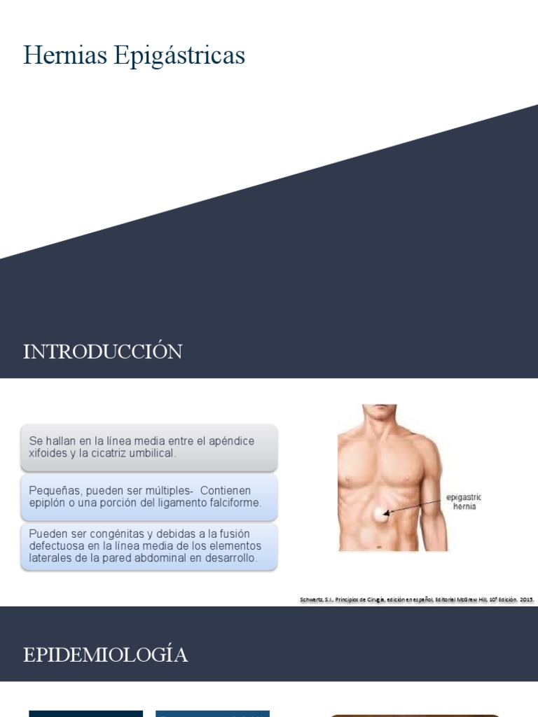 Hernia Epigastrica | PDF | Medicina CLINICA | Especialidades Medicas