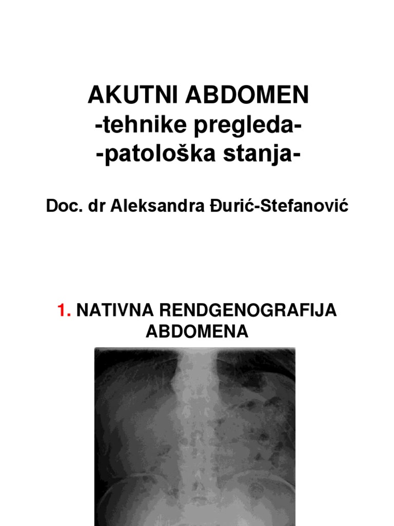 Akutni Abdomen-Djuric A | PDF