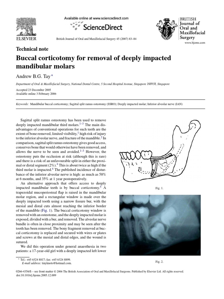 British Journal of Oral and Maxillofacial Surgery 45-1-83 84 Buccal ...