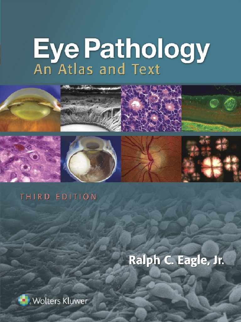 Eye Pathology An Atlas and Text | PDF | Retina | Epithelium