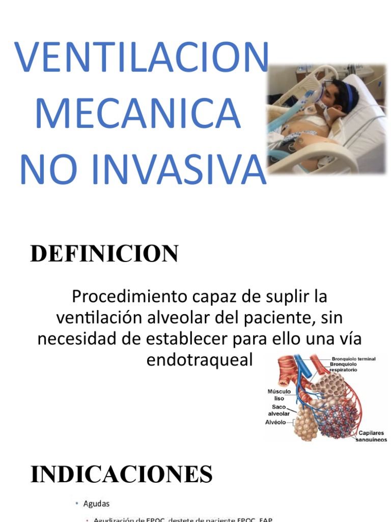 4.-Ventilacion Mecanica No Invasiva | PDF