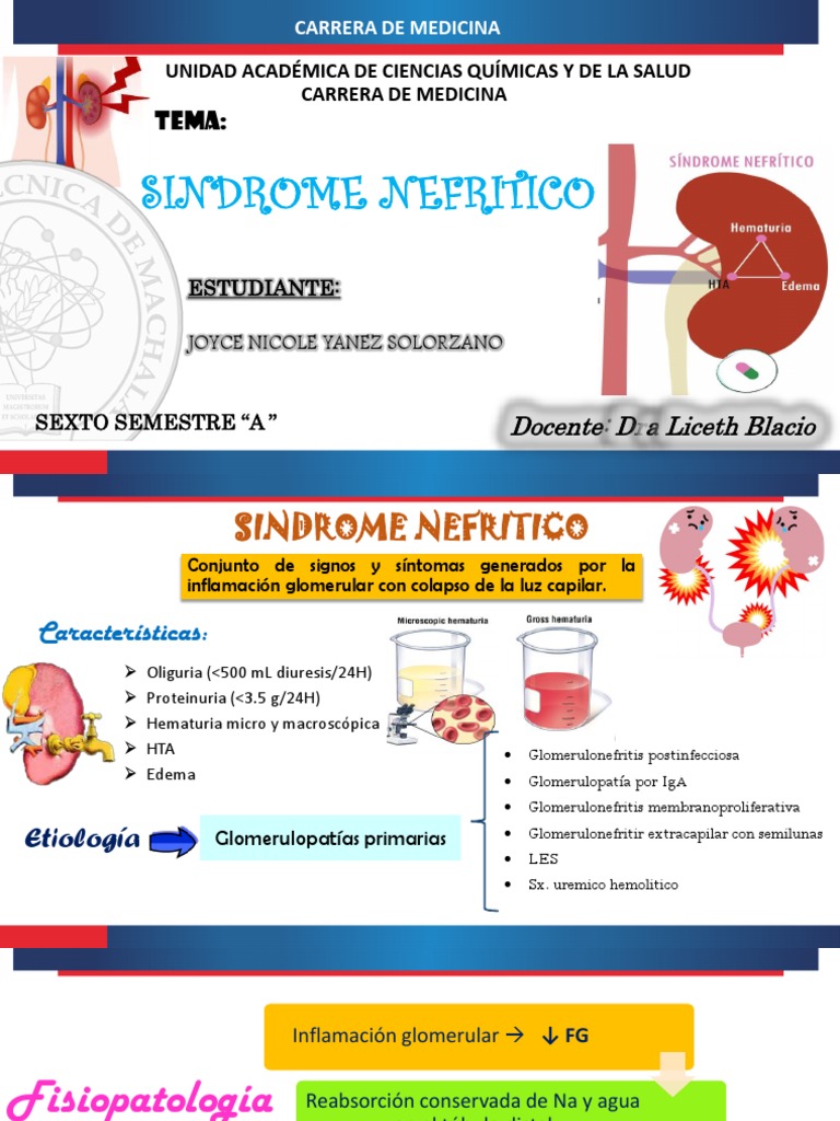SINDROME NEFRITICO. | PDF | Epidemiología | Especialidades Medicas