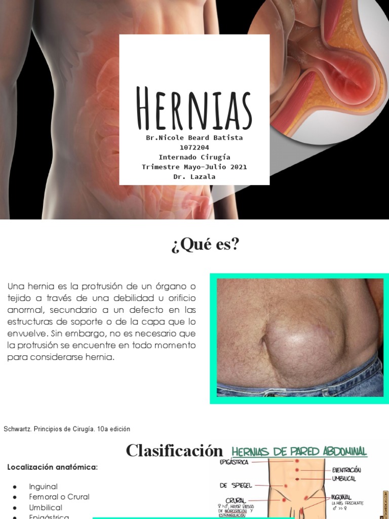 Hernias | PDF | Abdomen | Medicina CLINICA