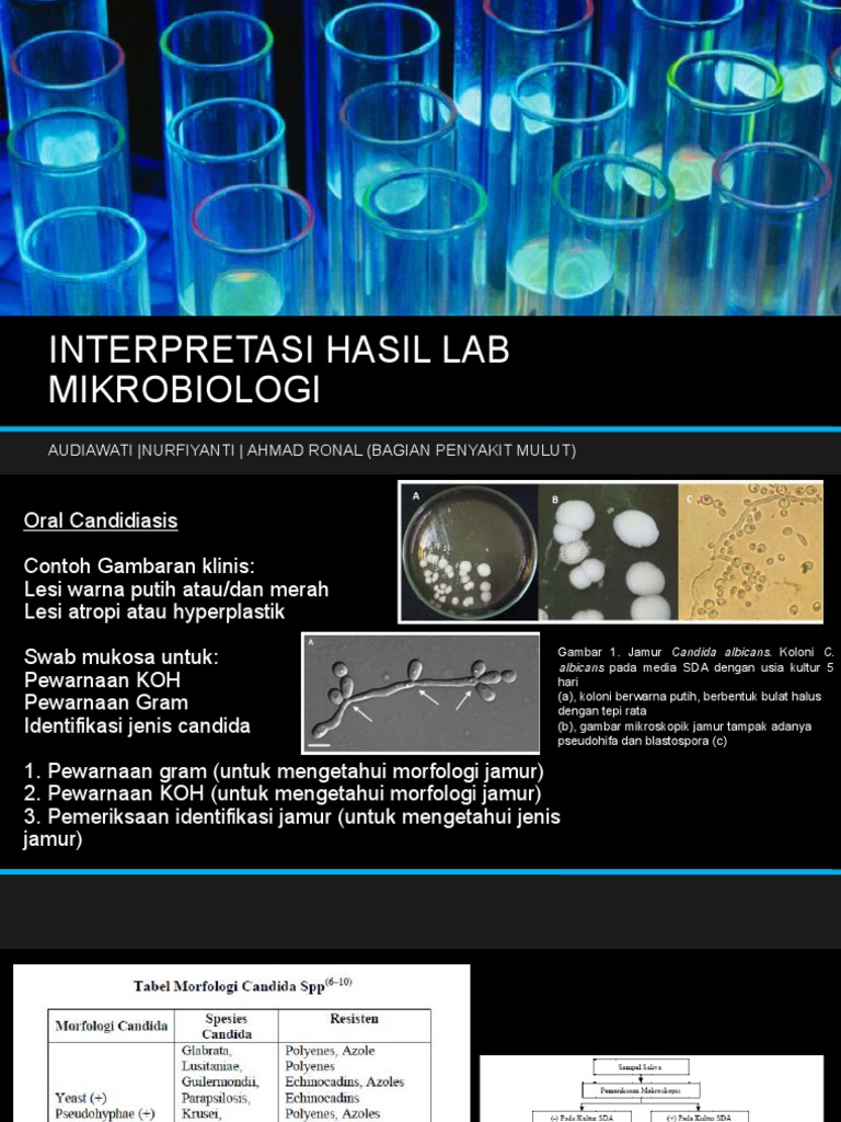 CSL Om Interpretasi Hasil Lab Mikrobiologi Kk5 K-2018 Ta 2021-2022 | PDF