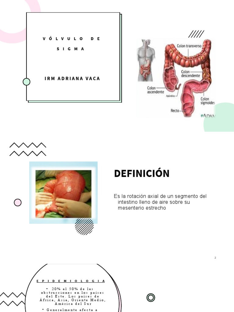 Volvulo de Sigma | PDF | Intestino grueso | Medicina