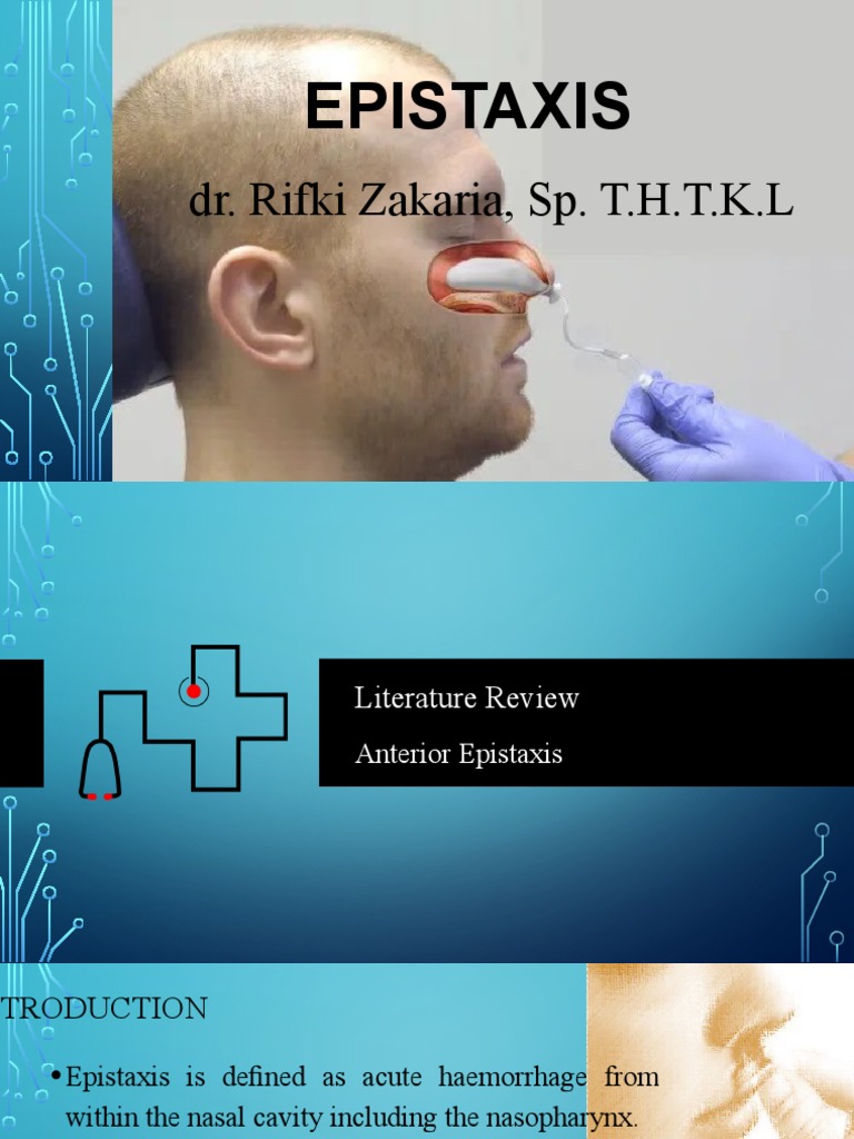 Managing Epistaxis: A Comprehensive Review of Anatomy, Etiology ...