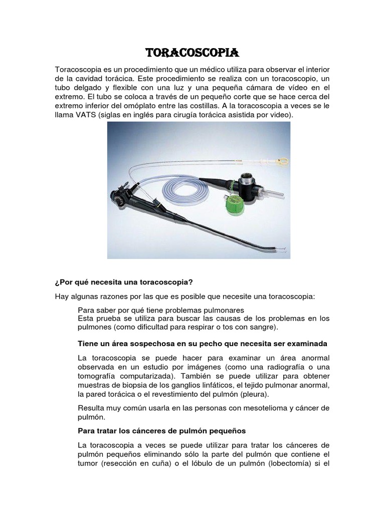 Toracoscopia FINAL | PDF | Cáncer | Cáncer de pulmón