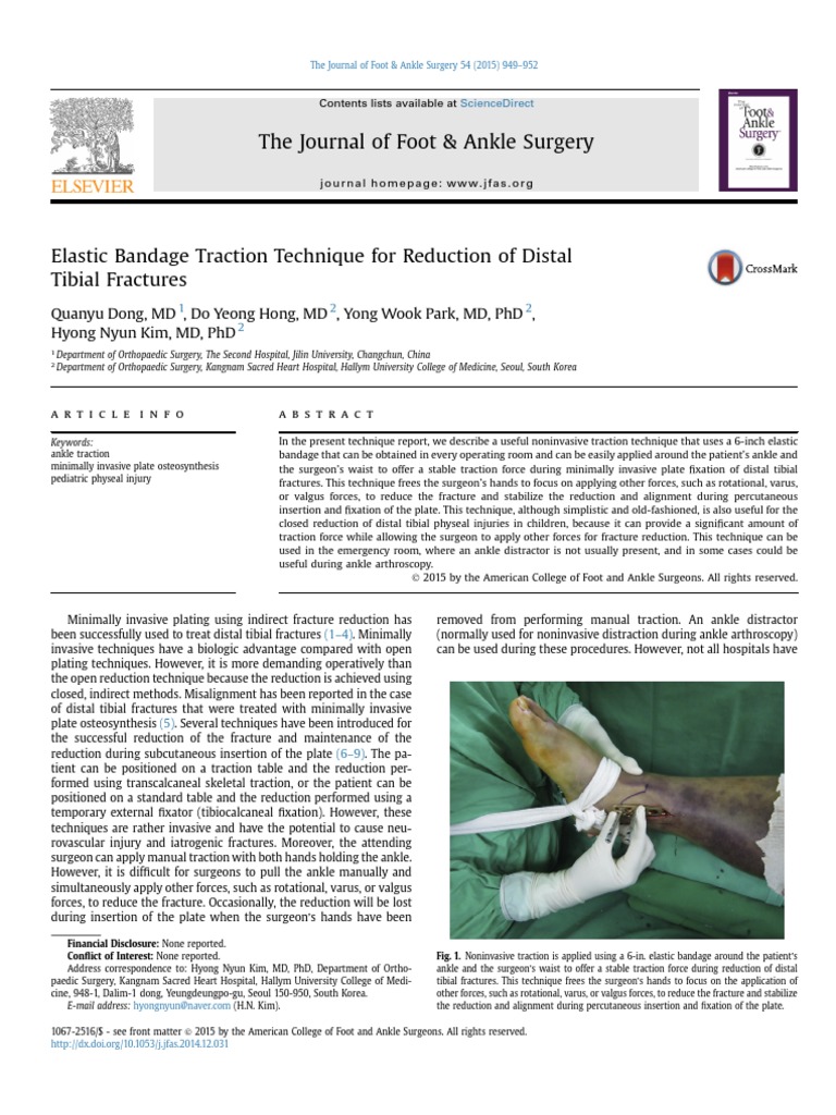 Elastic Bandage Traction Technique For Reduction of Distal Tibial ...