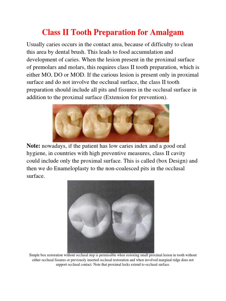 Class II Tooth Preparation For Amalgam | PDF | Tooth Enamel | Medical ...