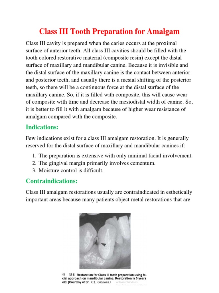 Class III Tooth Preparation For Amalgam: Indications | Download Free ...
