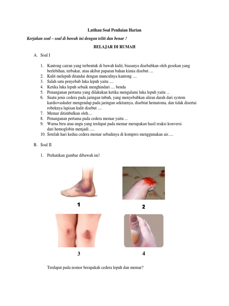 Soal Latihan Jenis Cedera Dan Cara Penanganannya | PDF