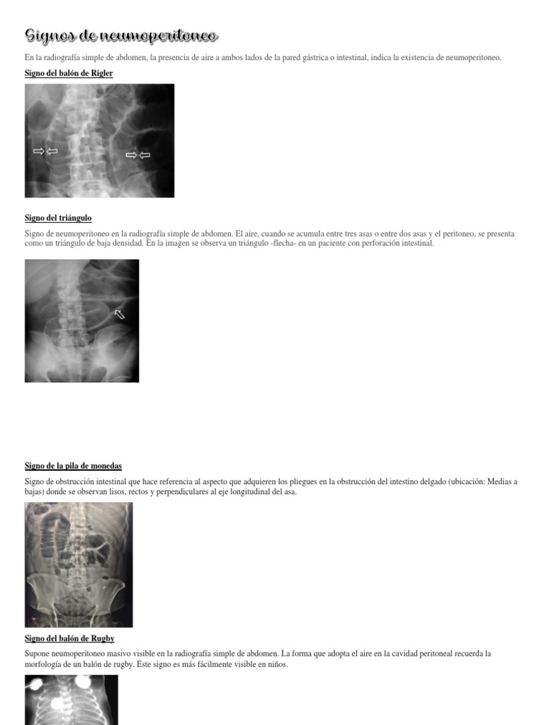 Signos de Neumoperitoneo | PDF | Abdomen | Hígado