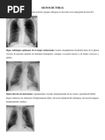 Signos de Esófago y Ulceras | PDF