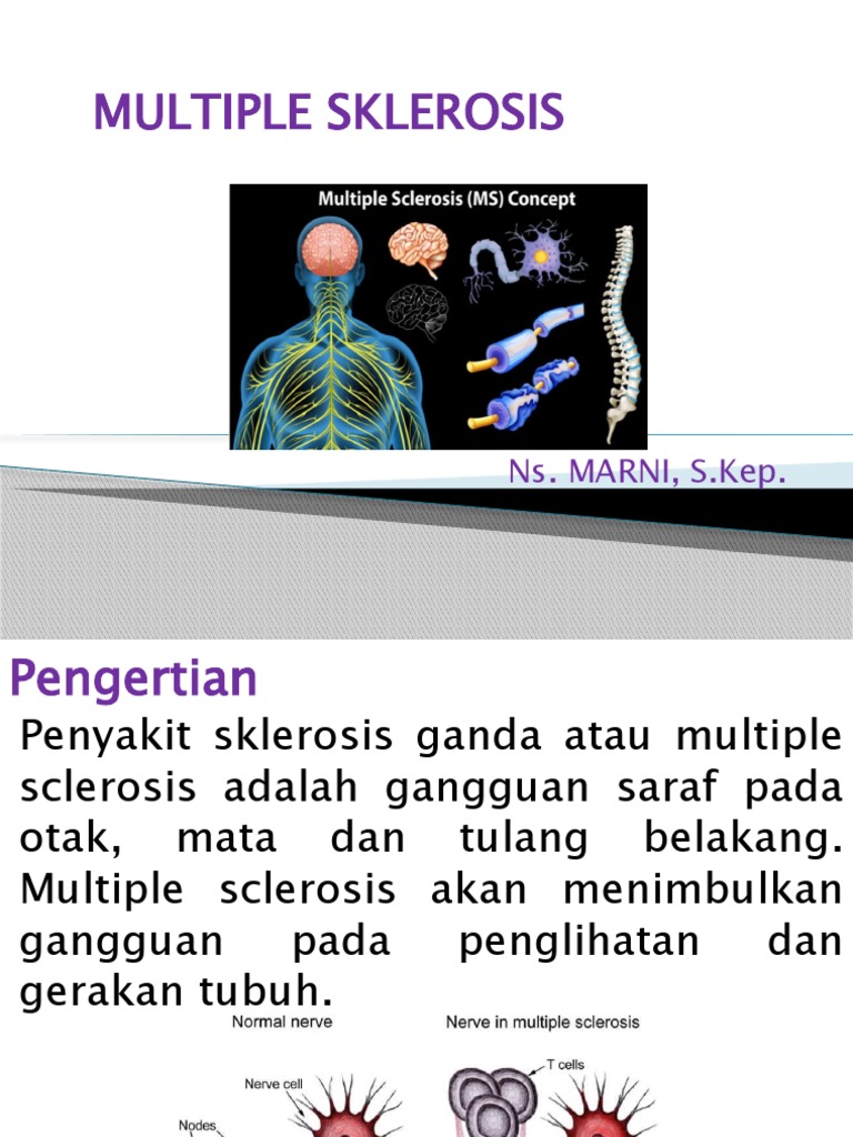 Multiple Sclerosis | PDF