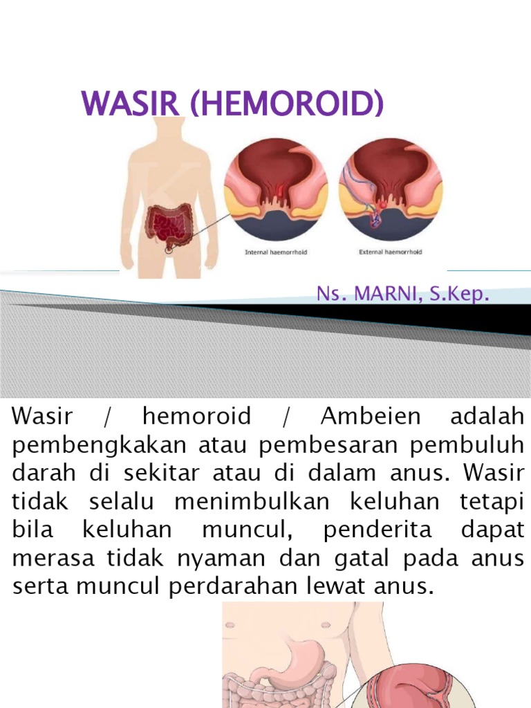 Wasir | PDF | Sains & Matematika | Gaya Hidup
