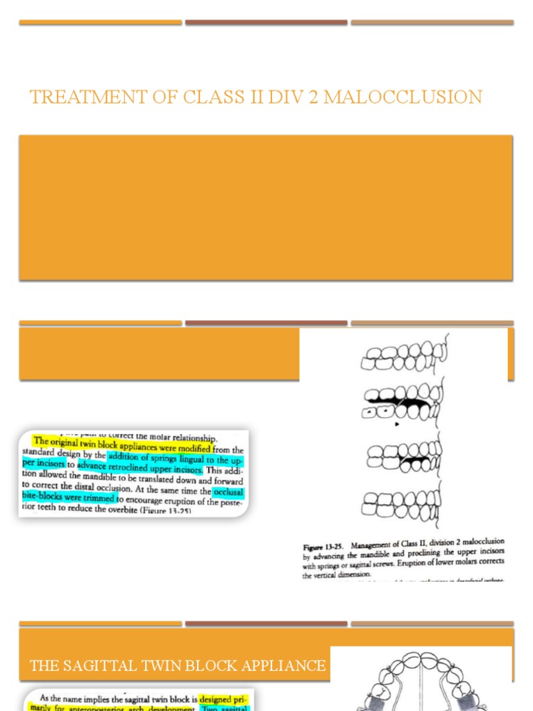 Twin Block Design in Class II Treatment | PDF | Science & Mathematics