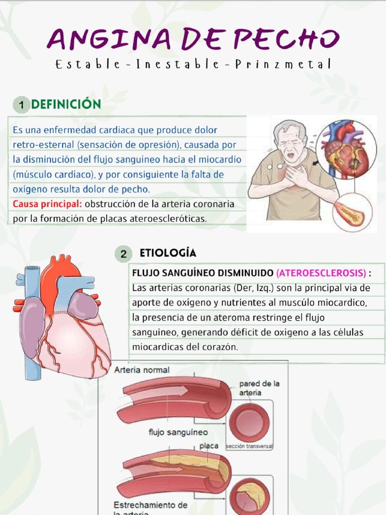 Tipos y Tratamientos de Angina de Pecho | PDF | Aterosclerosis | Epidemiología