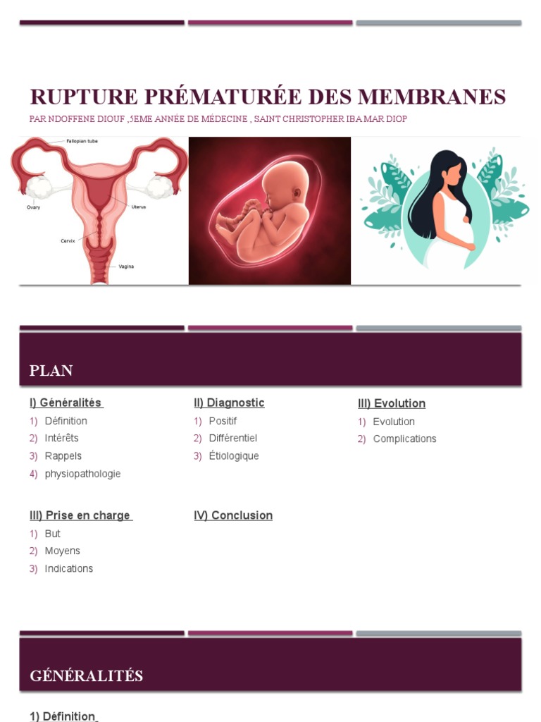 EL22:RUPTURE Prématurée Des Membranes | PDF | Sciences de la santé ...
