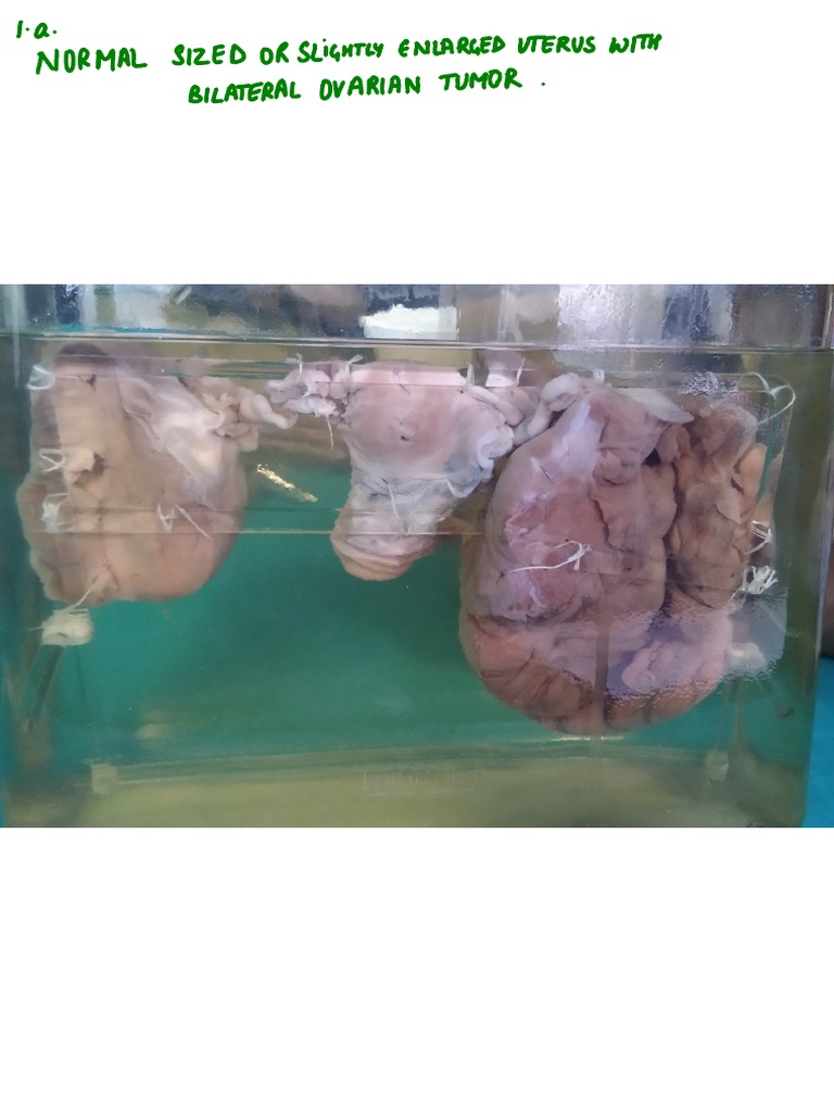 Gynae Obs Specimen | PDF