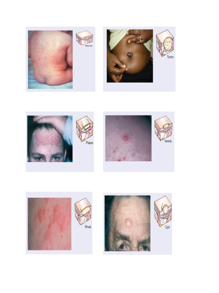 Skin Lesions | PDF