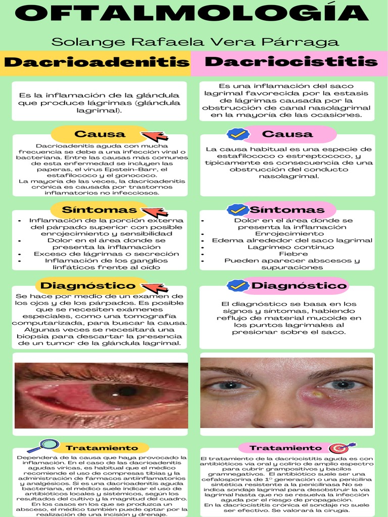 Diagnóstico y tratamiento de la dacrioadenitis y la dacriocistitis ...