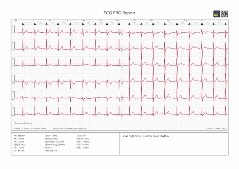 ECG Pro Report 189679 | PDF
