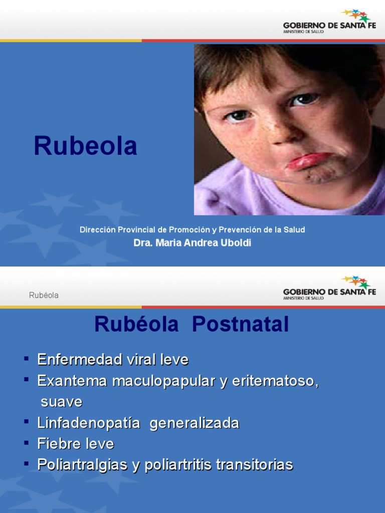 Prevención y Control de la Rubéola | PDF | Vacunas | Sarampión