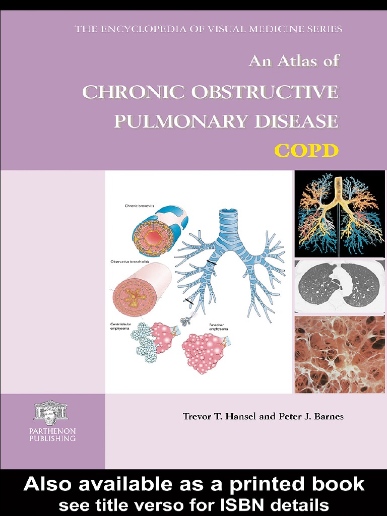 An Atlas of Chronic Obstructive Pulmonary Disease, COPD (Hansel, Trevor T. Barnes, Peter J ...