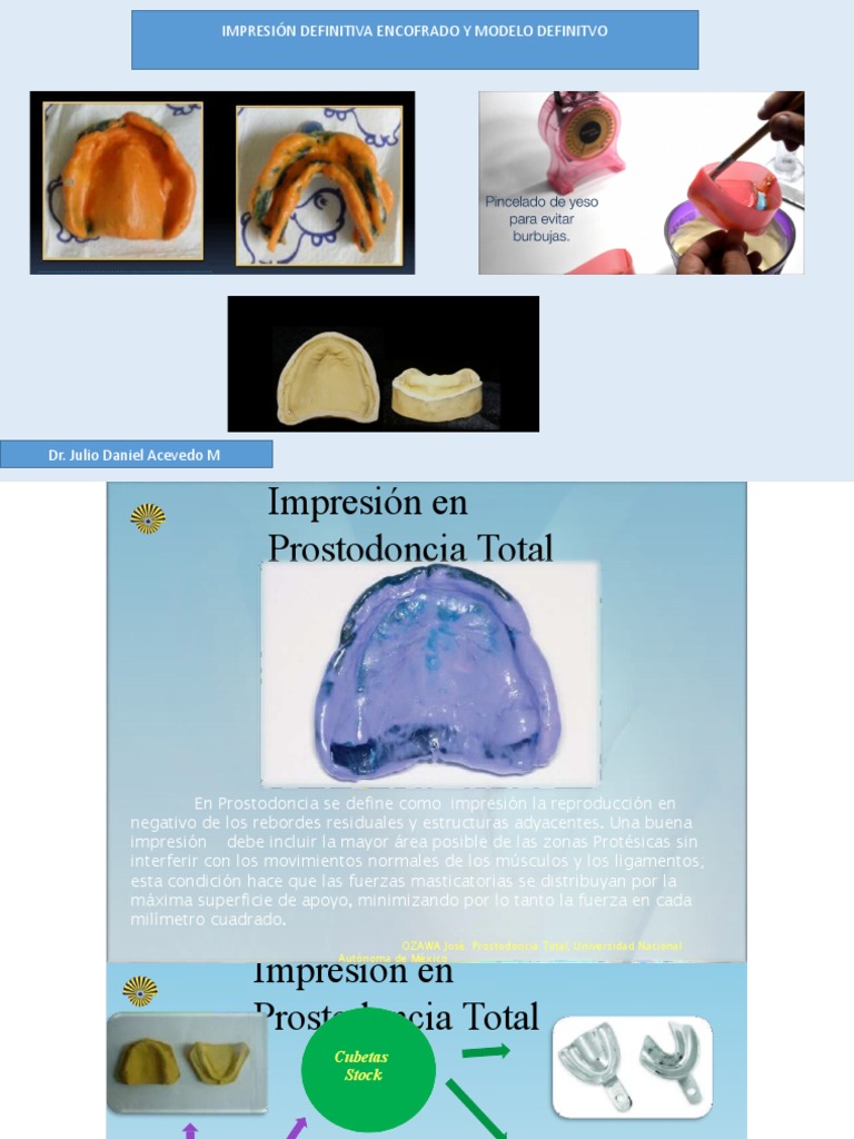 Modelo definitivo en Prostodoncia Total | PDF | Silicona | Agua
