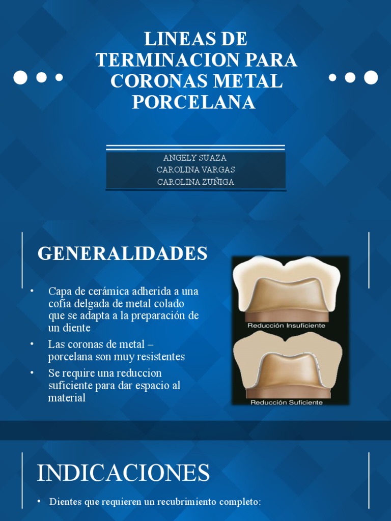 Preparación de Coronas Metal Porcelana | PDF | Diente | Cerámica