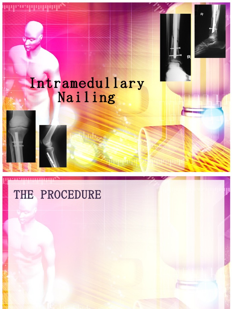 Nursing Responsibilities for Intramedullary Nailing | PDF | Self ...